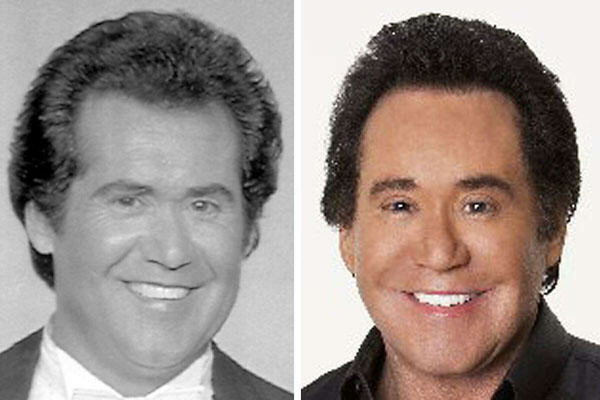 Male plastic surgery gone awry