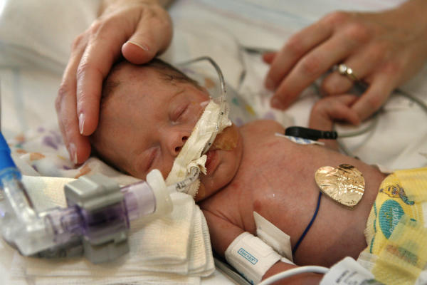 New procedure saves preemie in Houston