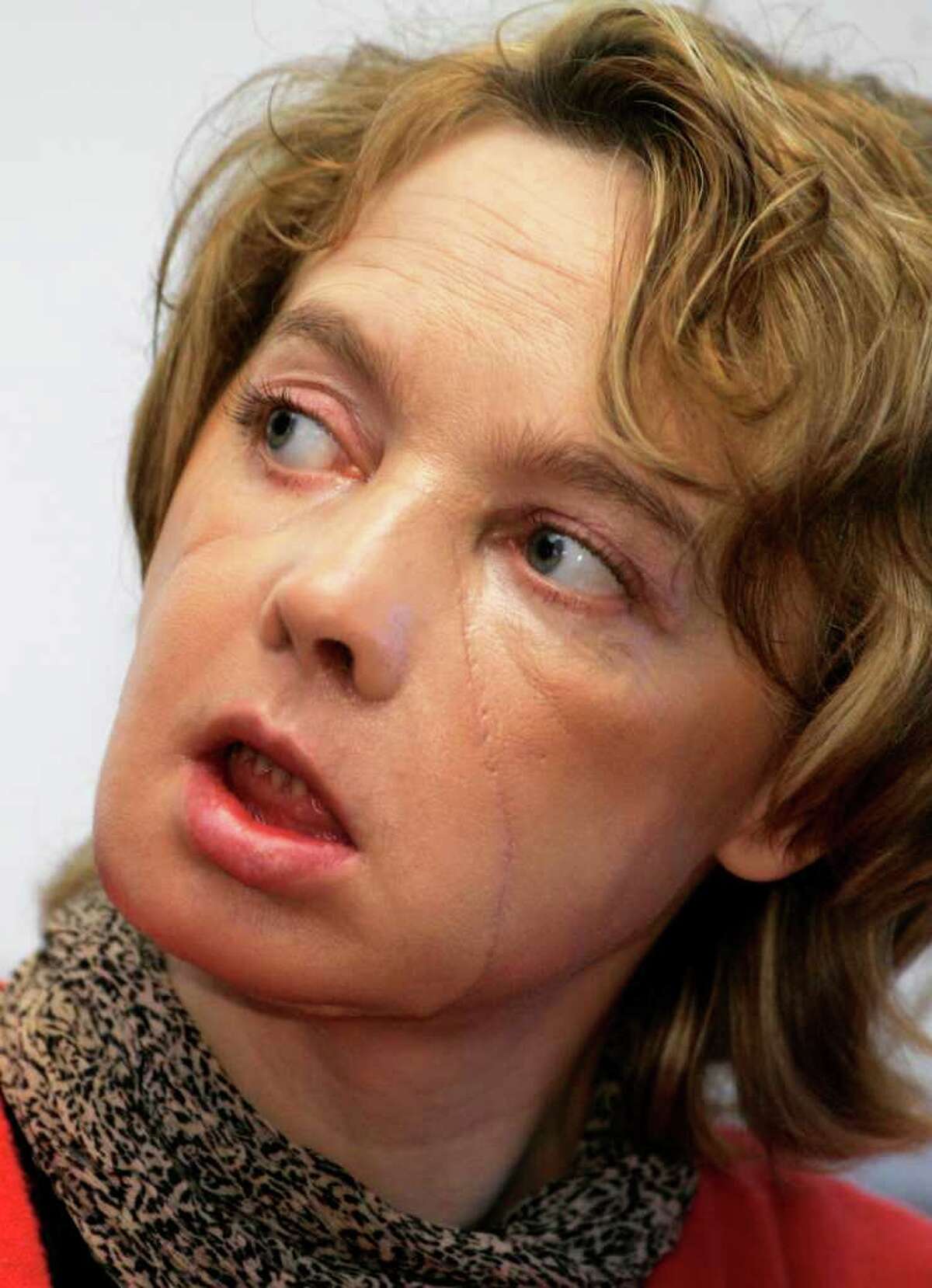 New face gains acceptance