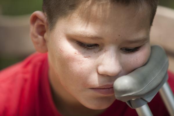 Mauling survivor, 10, blames owners — not dogs