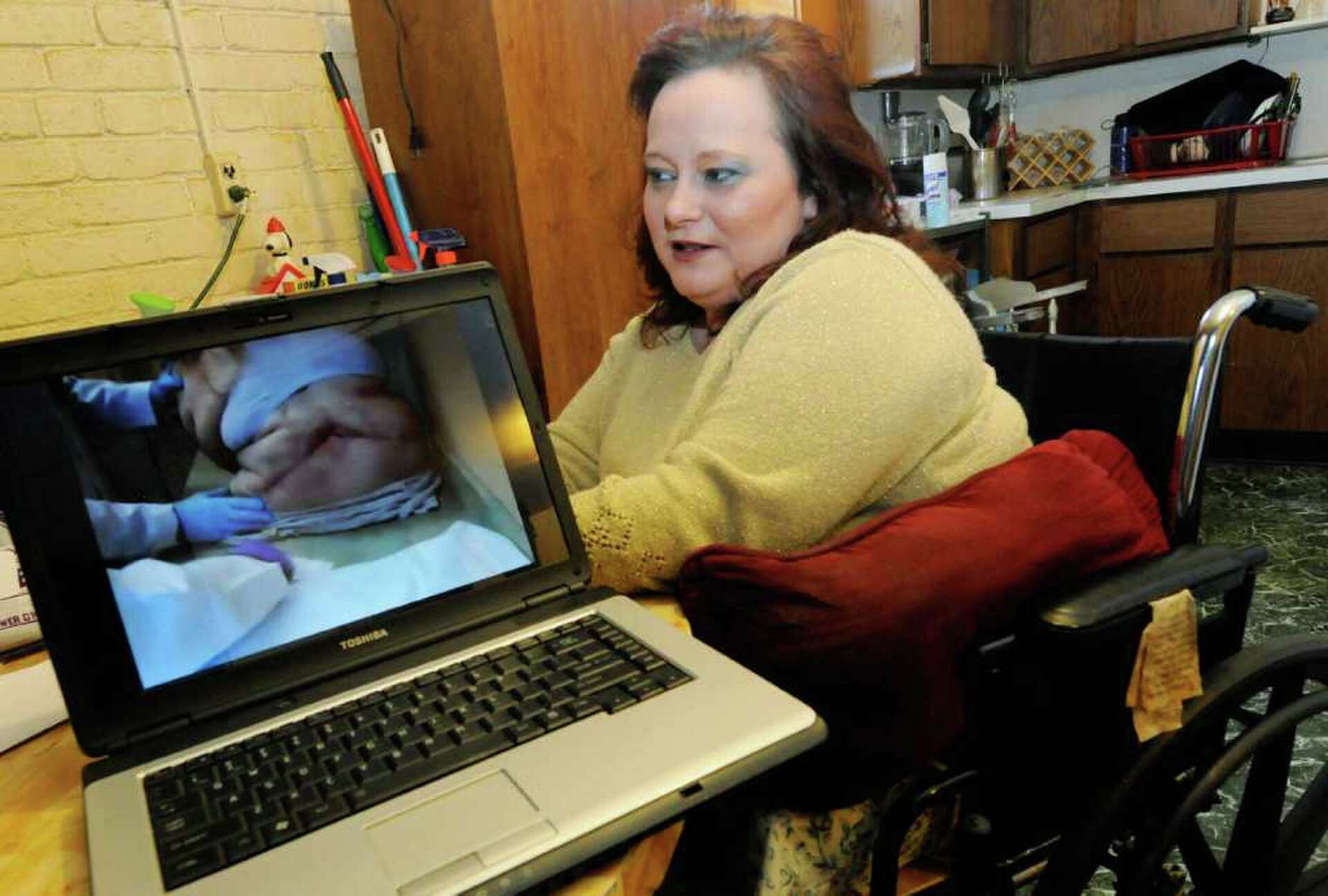 Despite operation to cut her in half, Angel laughs on