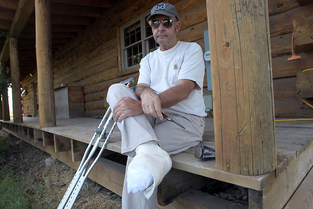 Logger, forced to hack toes, recalls intense pain