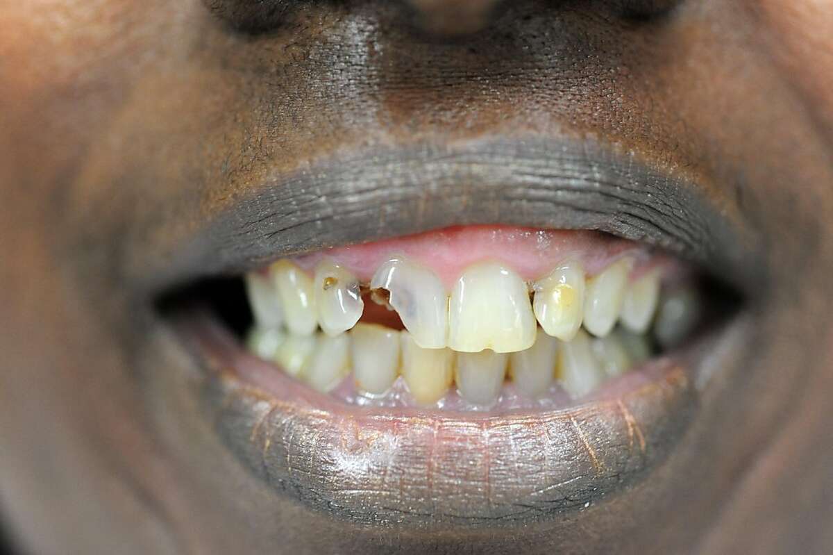 Free dental care gives uninsured a reason to smile