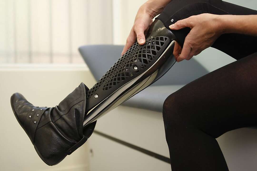 Bespoke creates prosthetic leg case using 3-D tech