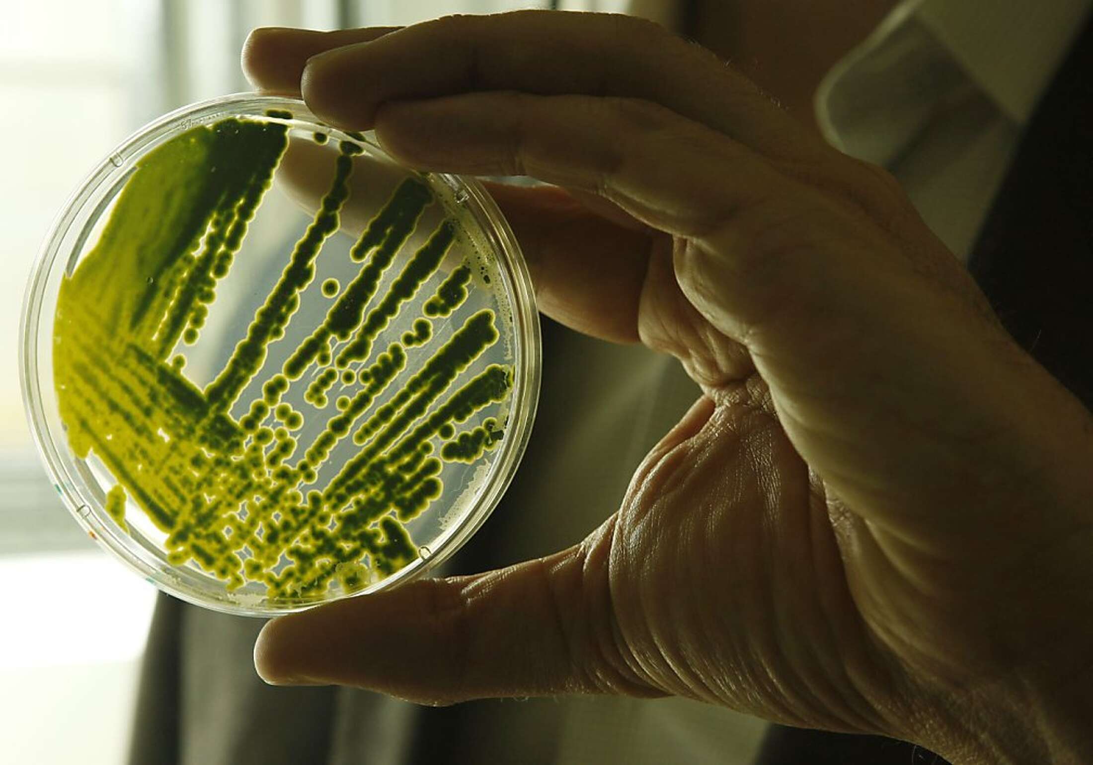 Algenist uses Solazyme microalgae for anti-aging