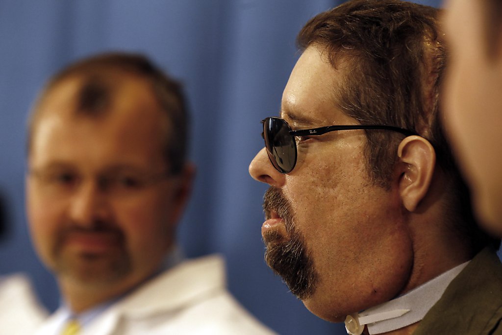 Full-face transplant recipient makes 1st appearance