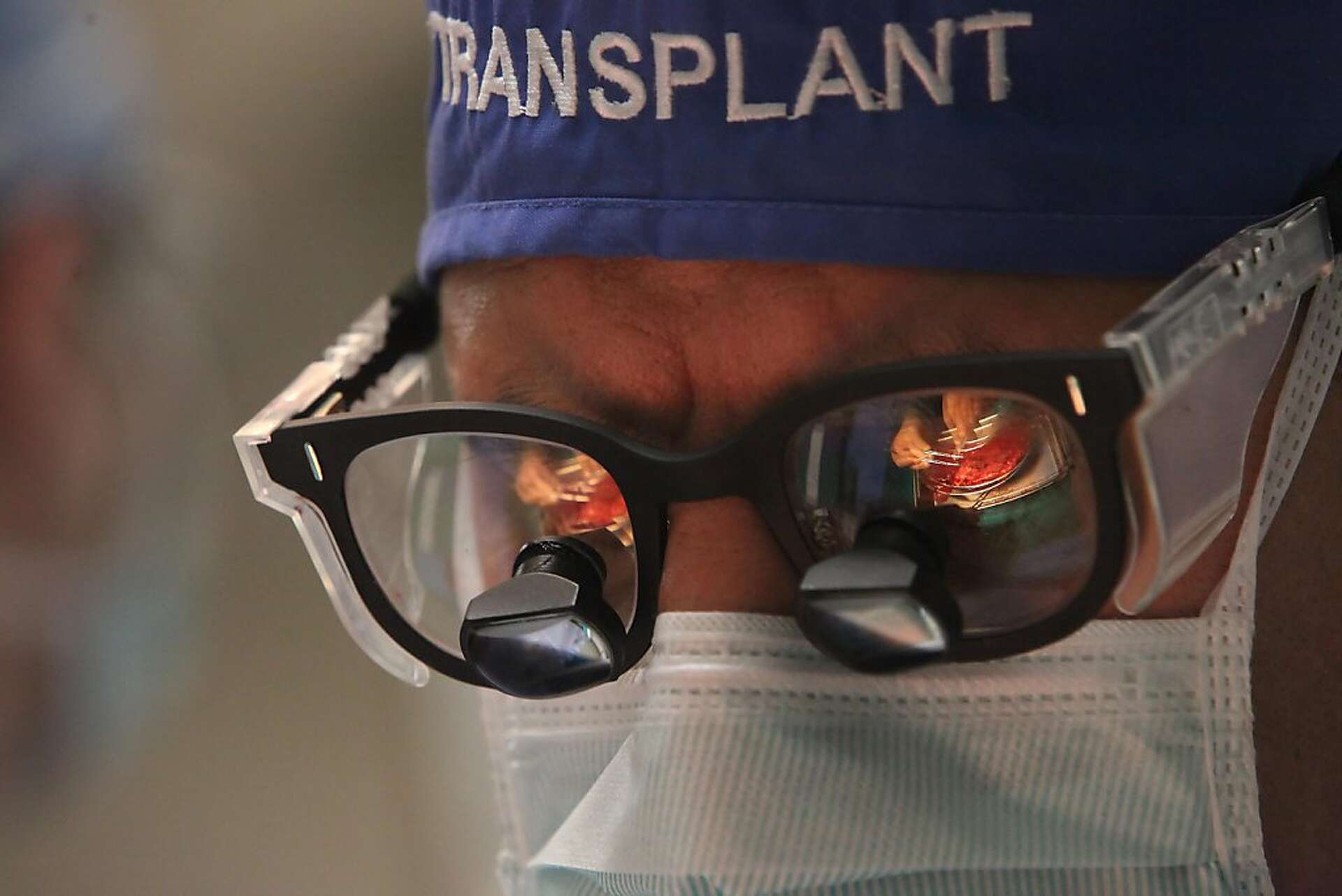Hospital's 5-transplant kidney swap a state record
