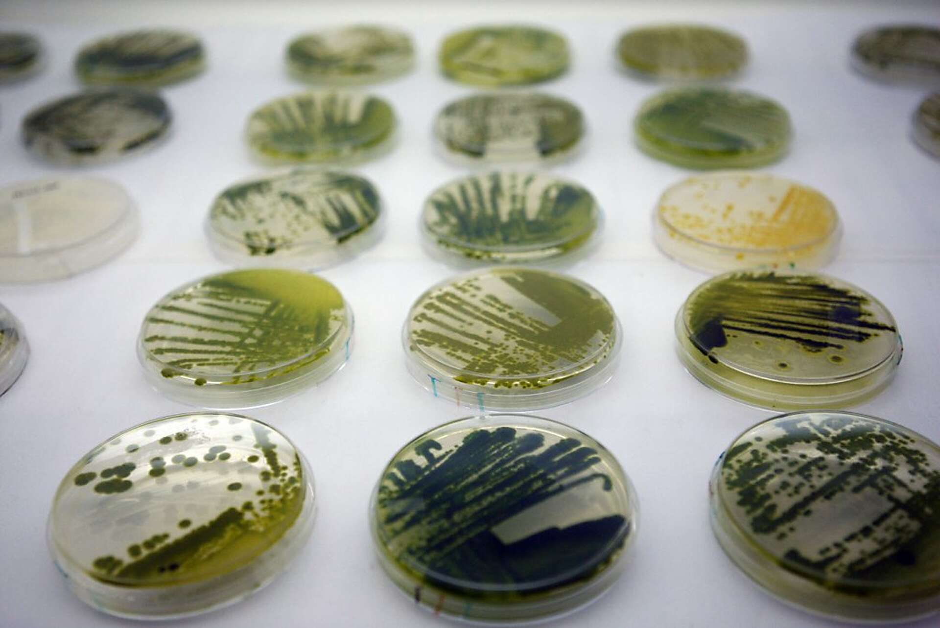 Algenist uses Solazyme microalgae for anti-aging