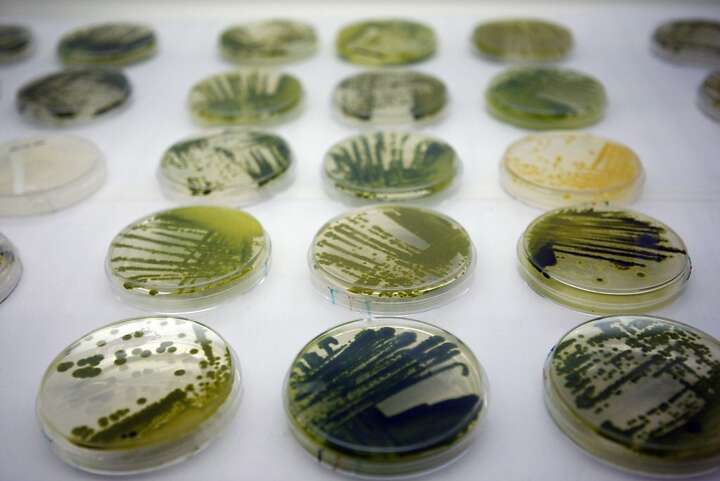 Algenist uses Solazyme microalgae for anti-aging