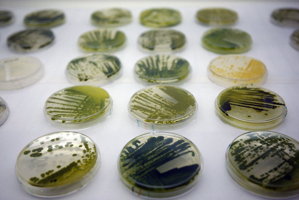 Algenist uses Solazyme microalgae for anti-aging