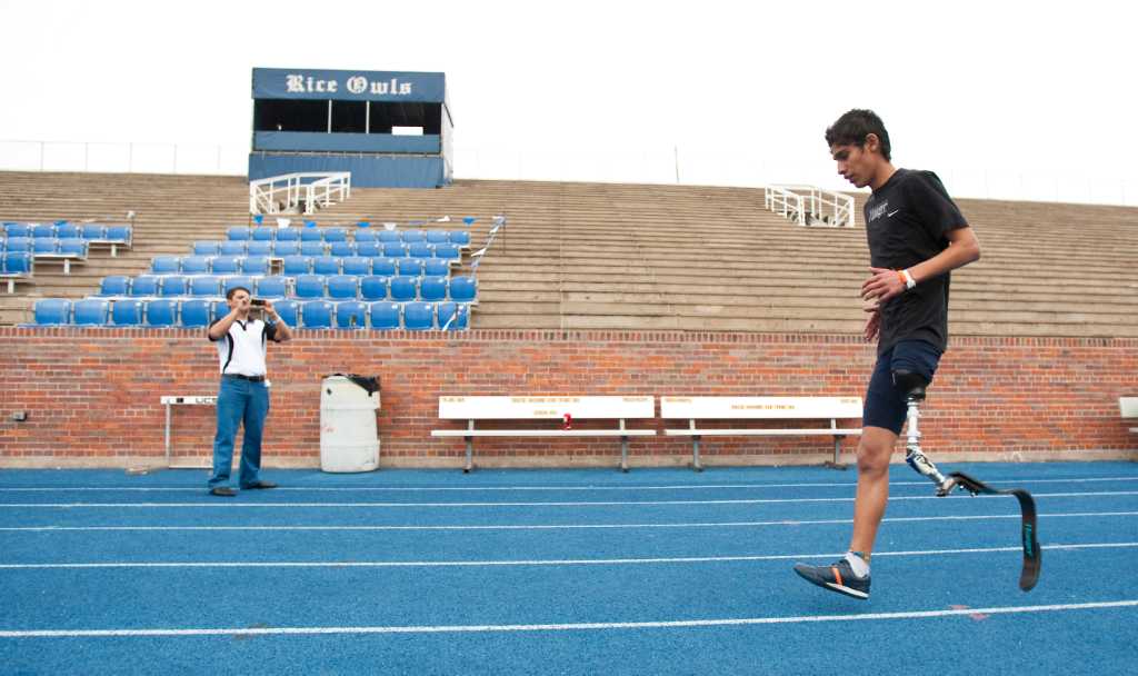 Runner from Mexico receives prosthetic leg