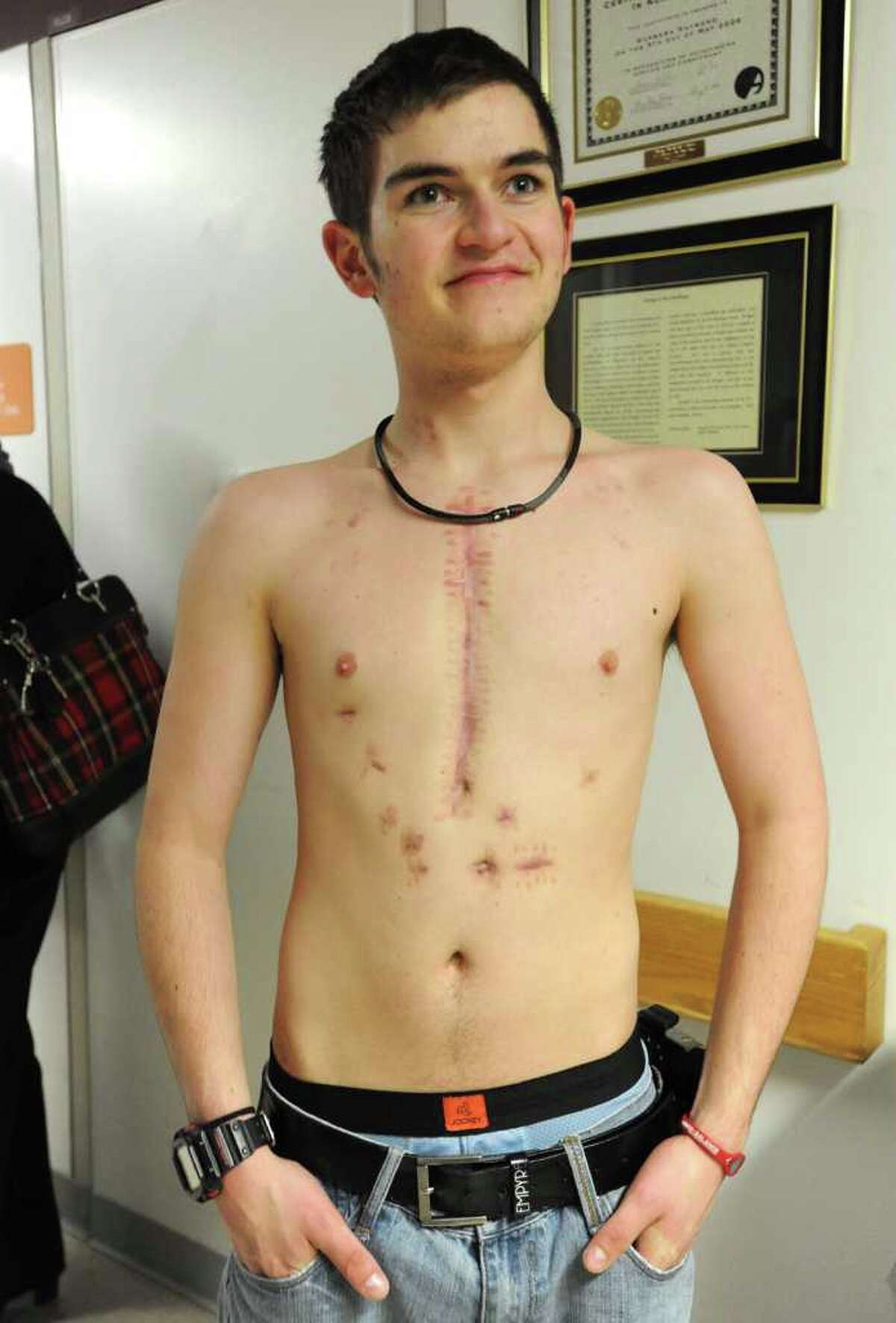 Without warning, death was near