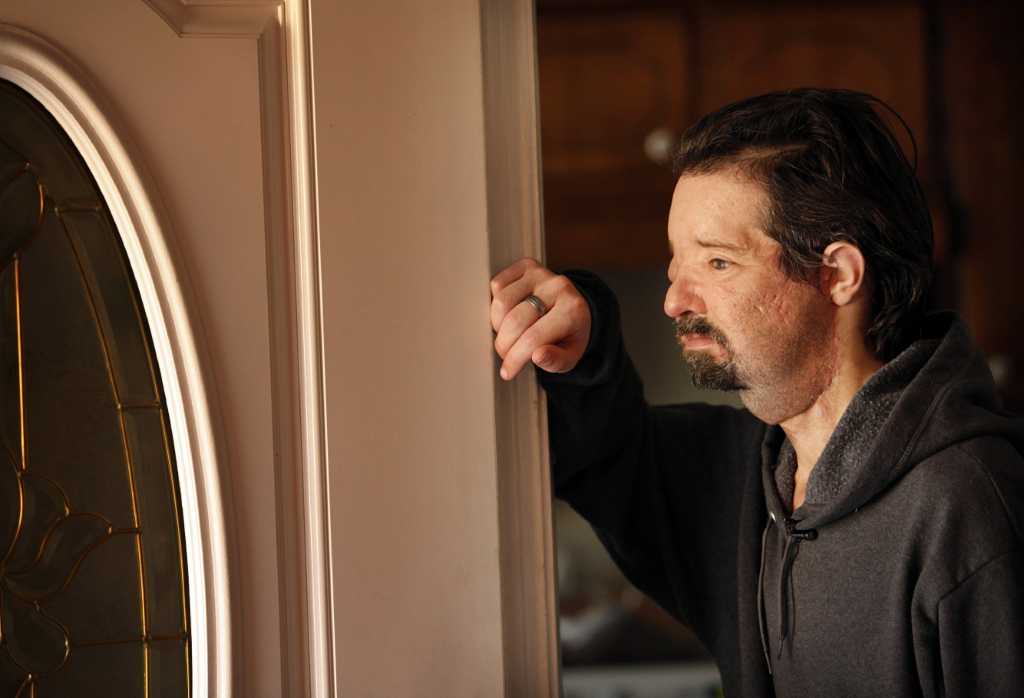 His new face has man smiling again