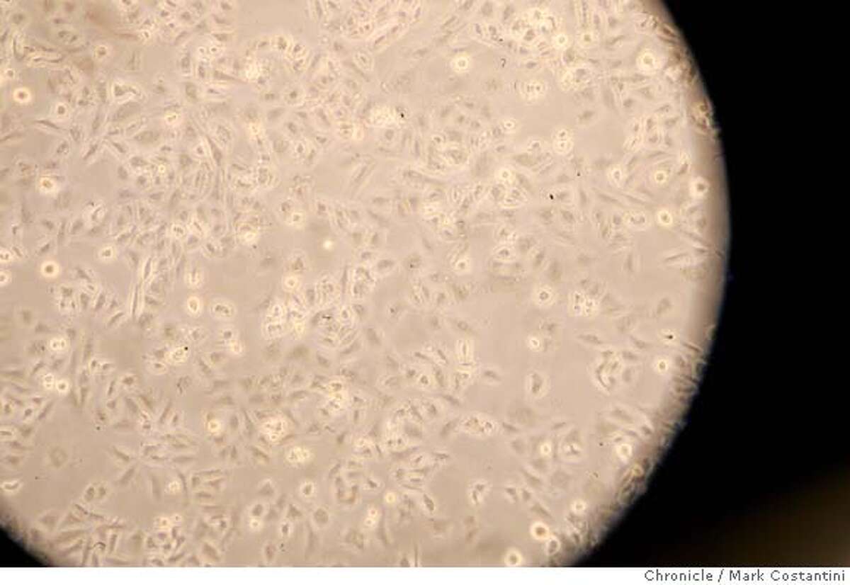 Brothers in Arms / Working nights at UCSF to cure mesothelioma, spurred ...