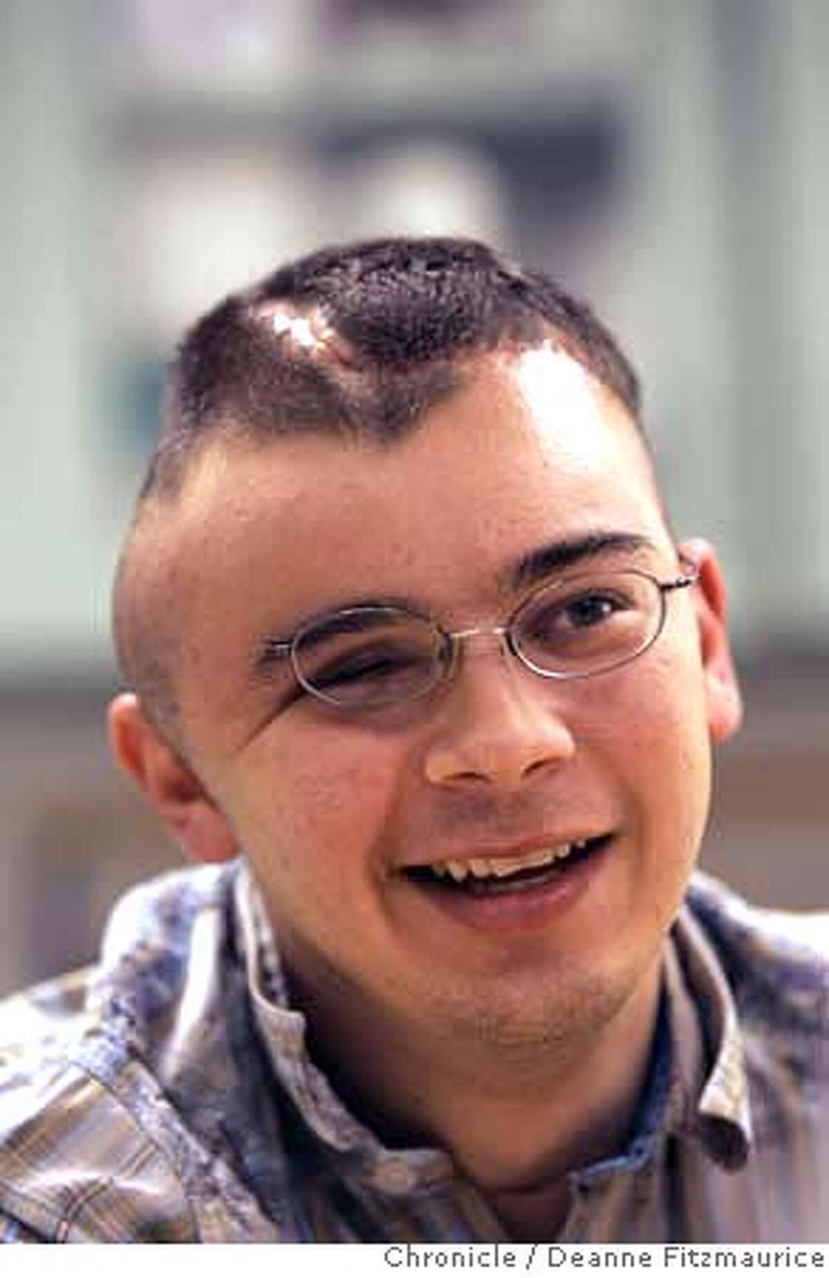 Living with the scars of war / A CONFLICT'S PAINFUL LEGACY: Thousands ...