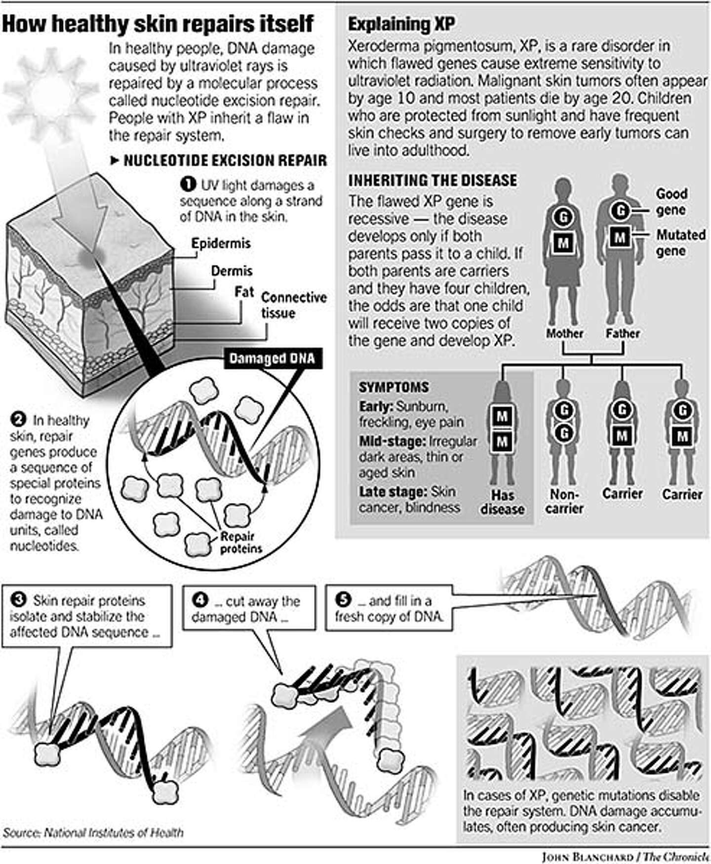 LIVING IN THE SHADOWS / Bay Area doctors join fight against a rare ...