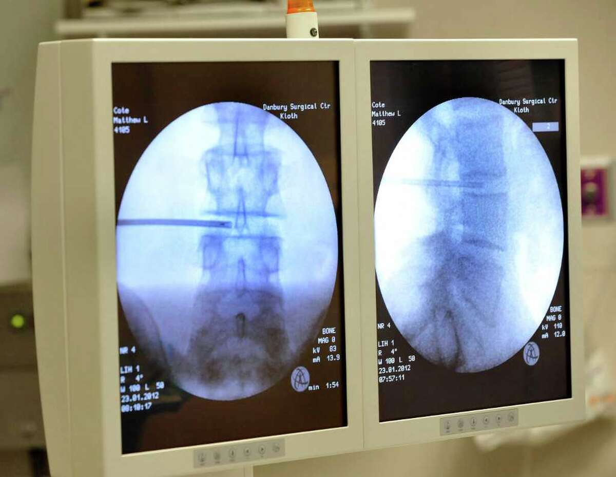 Doctor donates surgery to help patient in pain