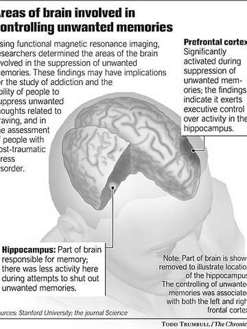 Brain is built to forget, research says / MRIs in Stanford study show ...