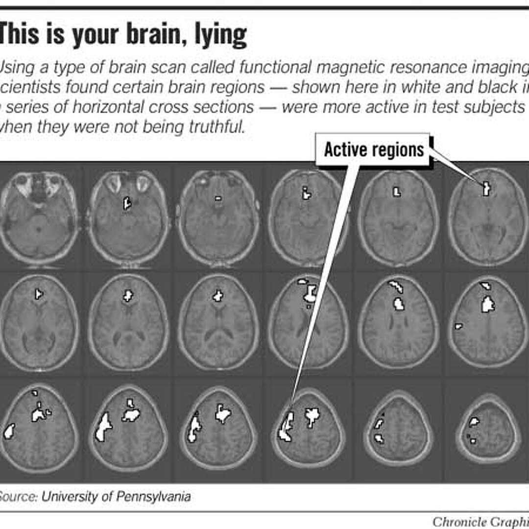 Fib detector / Study shows brain scan detects patterns of neural ...