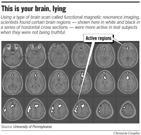 Fib detector / Study shows brain scan detects patterns of neural ...