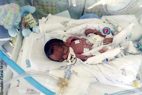 BABY LOUIE'S SECOND BIRTHDAY / Preemie's steady progress heartens his ...