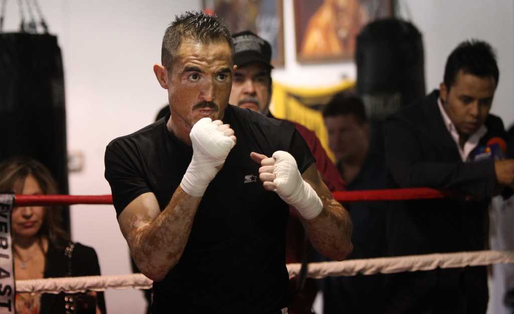 Martinez breaks down dome boxing matchups