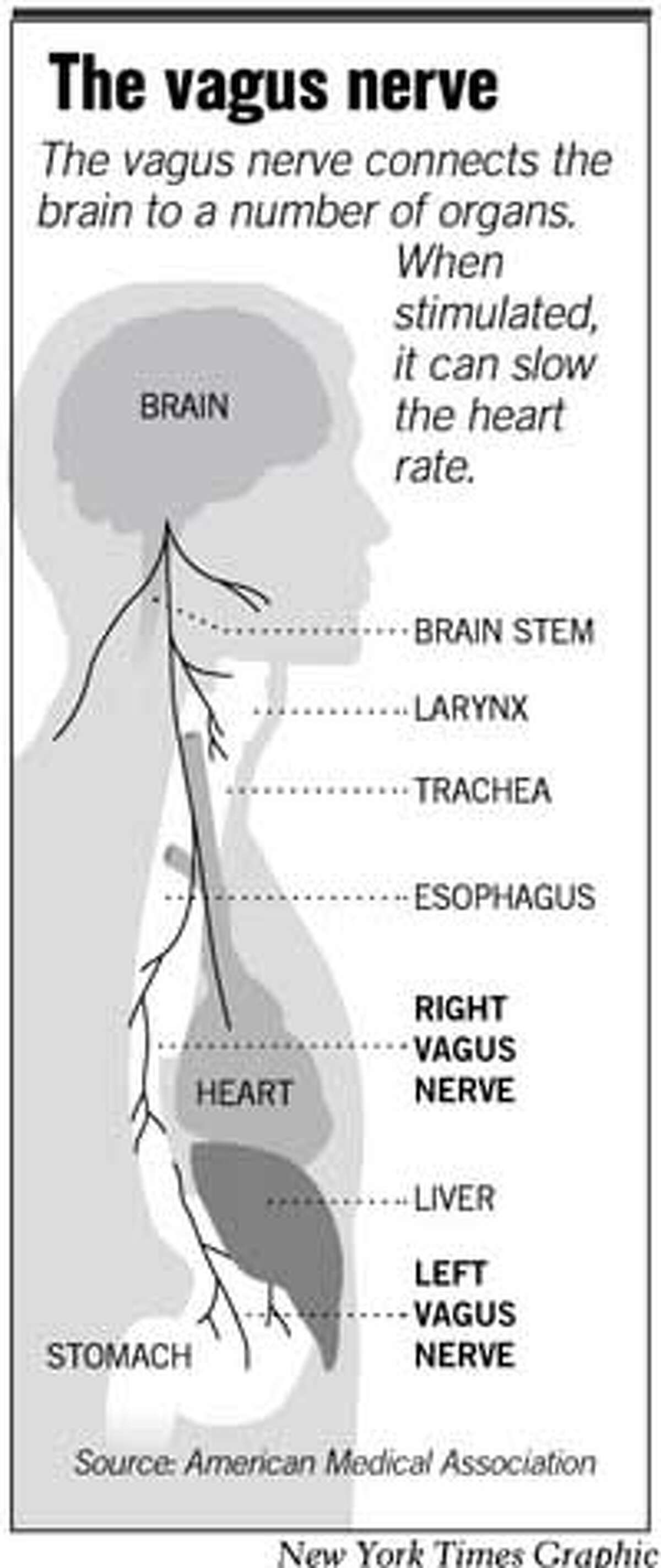 Doctors coughing up reasons for Bush's fainting spell