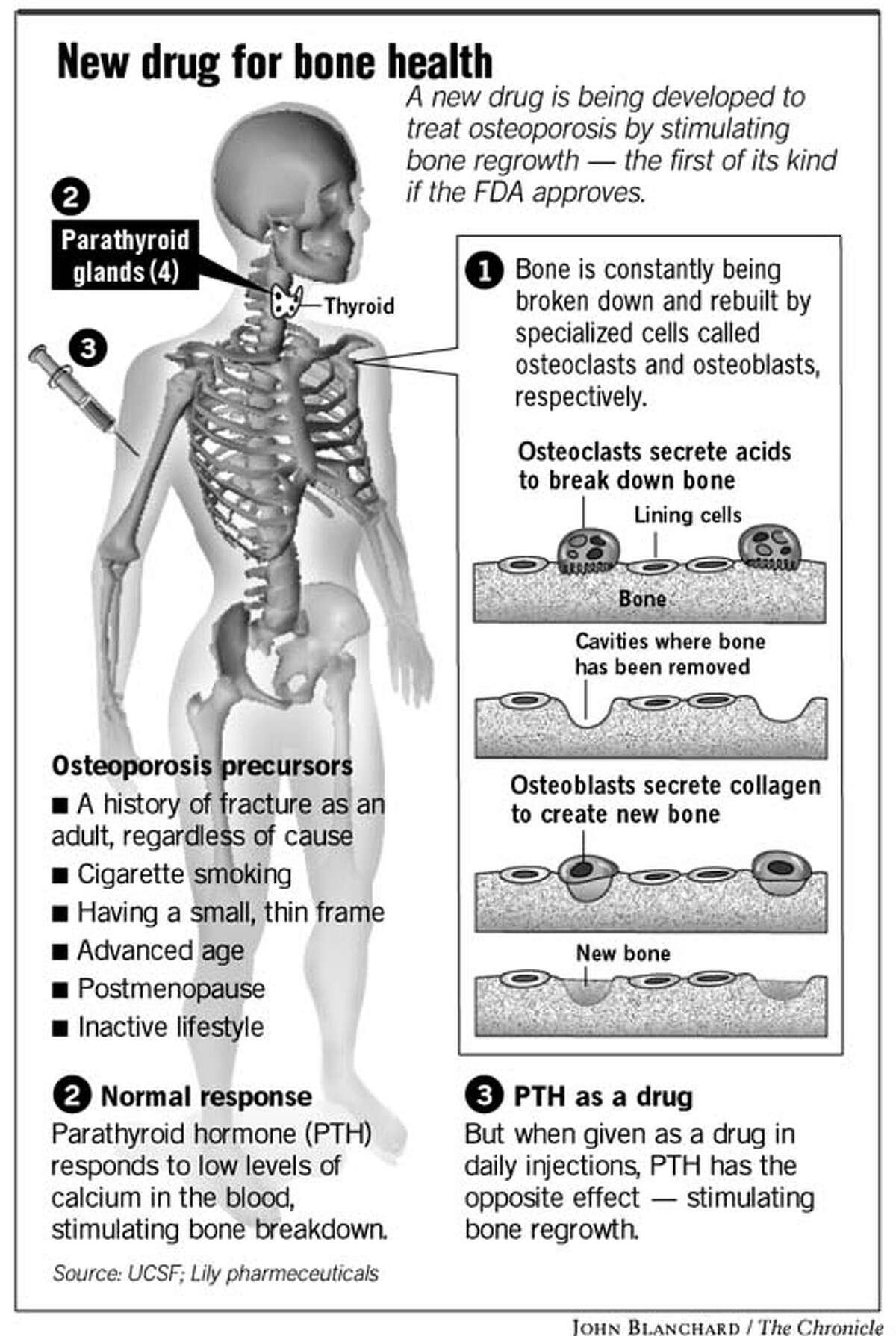 Osteoporosis breakthrough rebuilds brittle, decayed bone