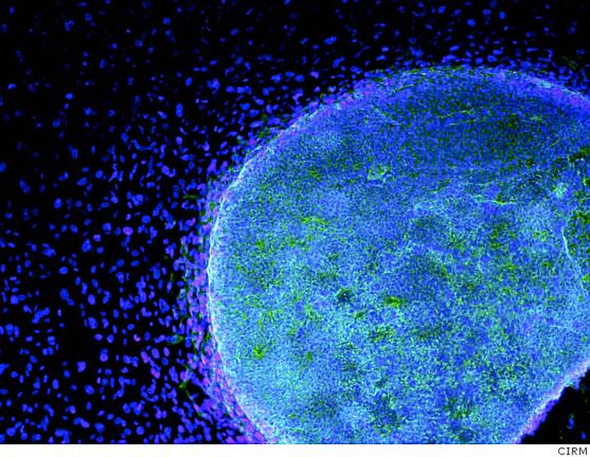 Stem cell approval cheered in California