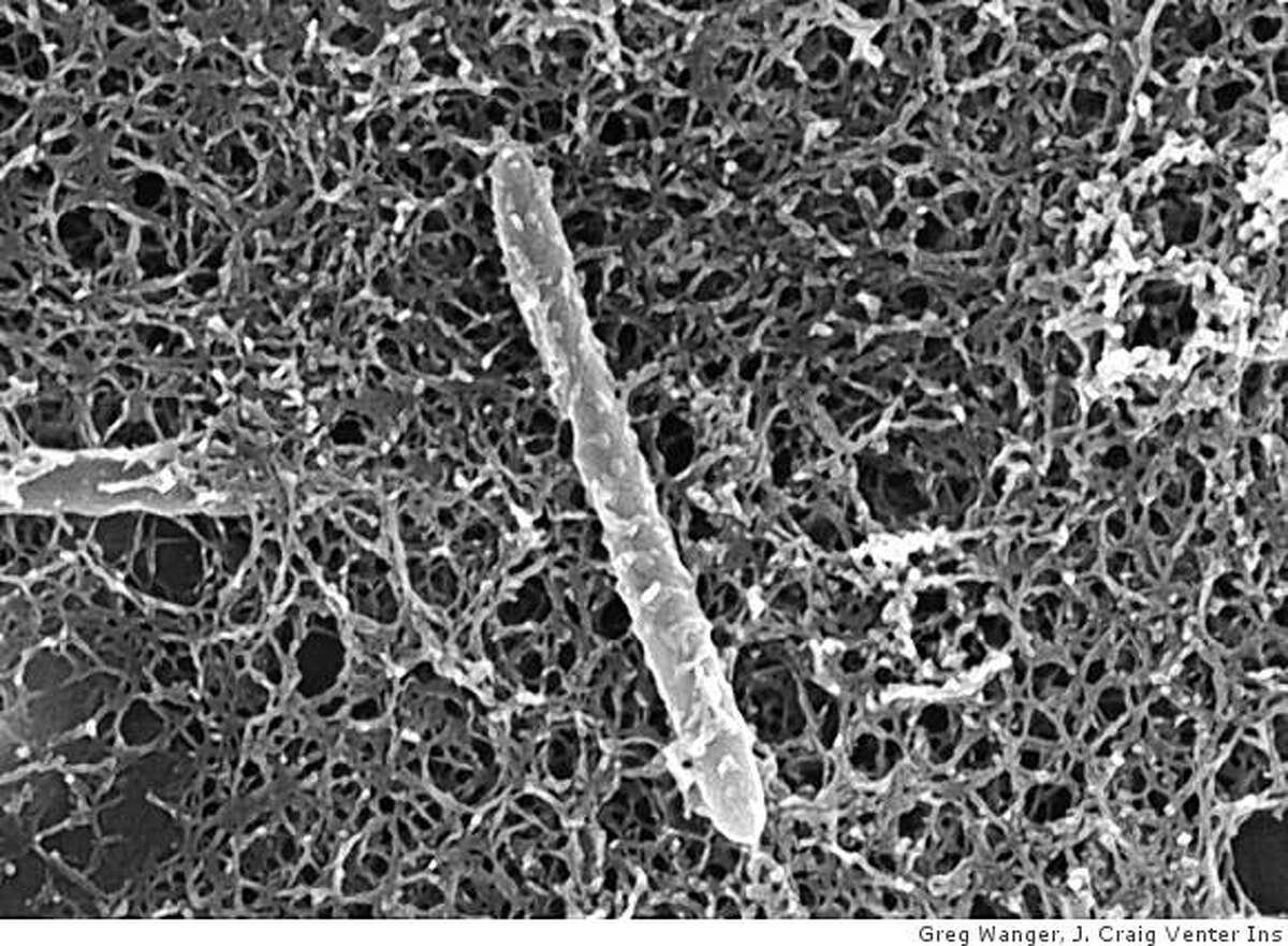 The tale of a curiously extreme microbe