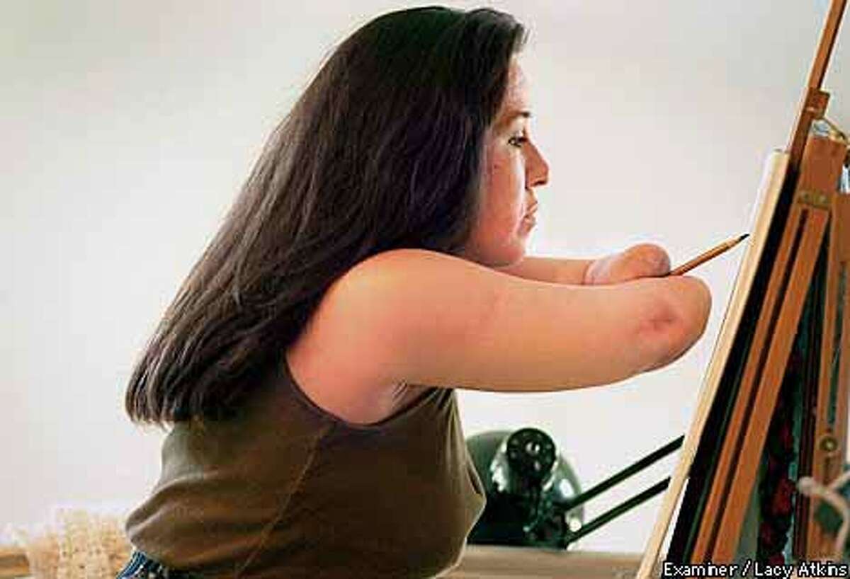 From basket case to wonder woman