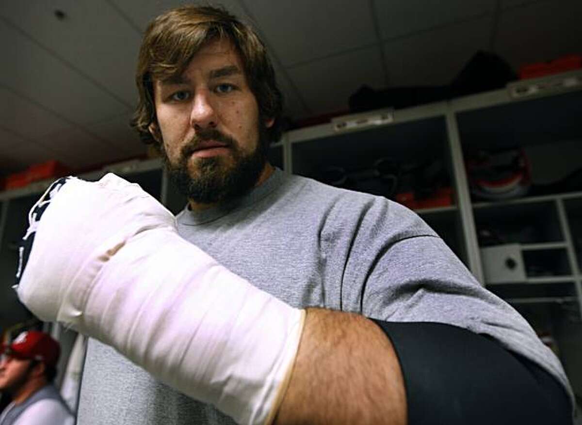 Snyder's tale of the tape