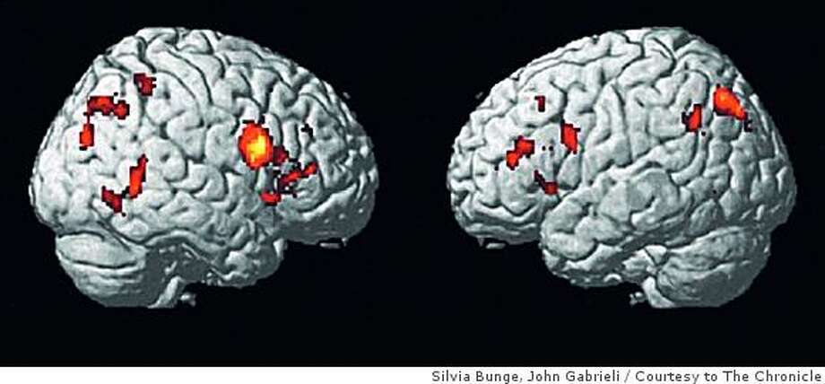 Complex brain imaging is making waves in court - SFGate