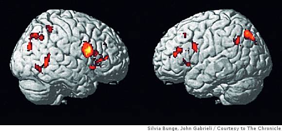 Complex brain imaging is making waves in court