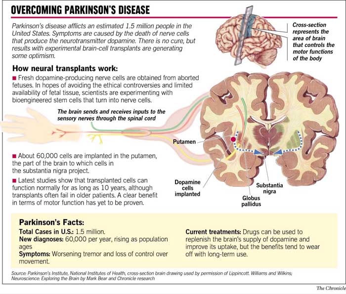 Promising Way to Repair Brain / Less controversial, more plentiful ...