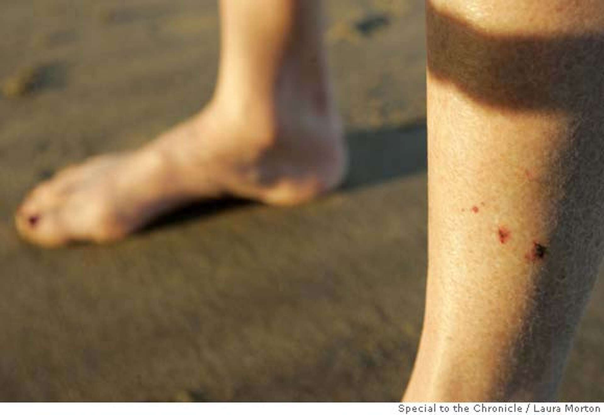 Swimmer bitten in 4th sea lion attack at SF’s Aquatic Park