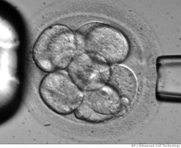 A new way to create stem cells / 'Pretty big technical leap' avoids ...