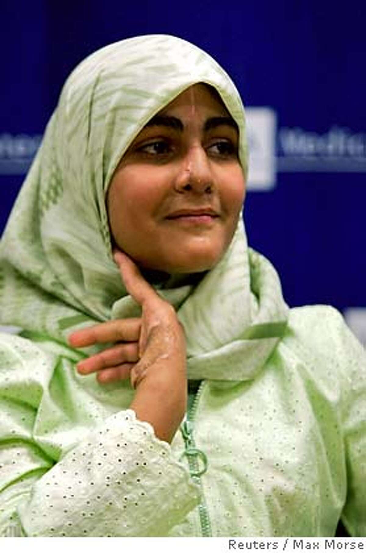 Girl goes home to Iraq with her nose restored / The U.S. air strike ...