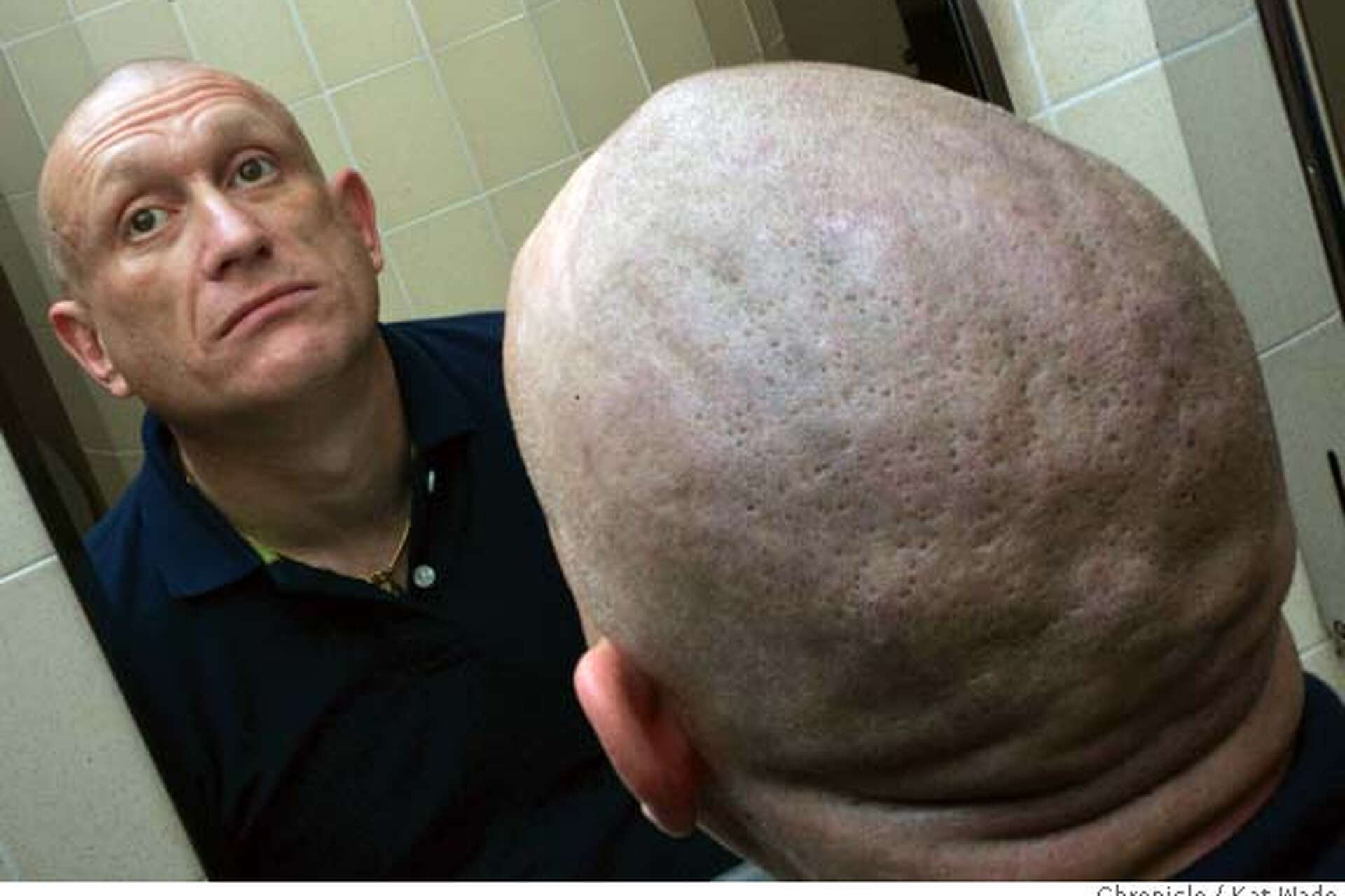 Nasty disease -- or is it delusion? / Thousands claim to have skin ...