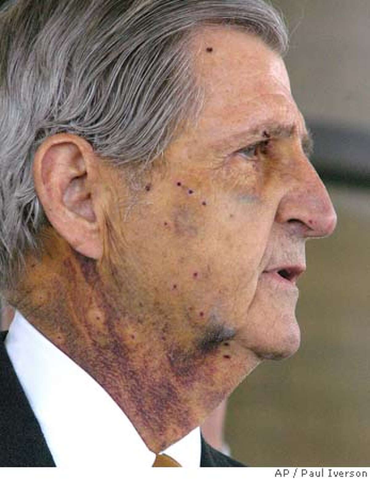 Cheney victim leaves hospital