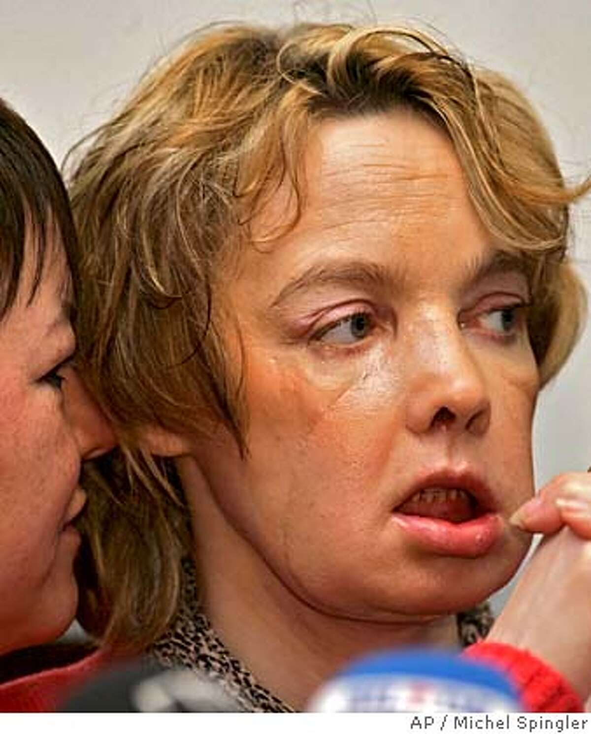 Face transplant woman appears / French citizen thanks doctors, donor ...