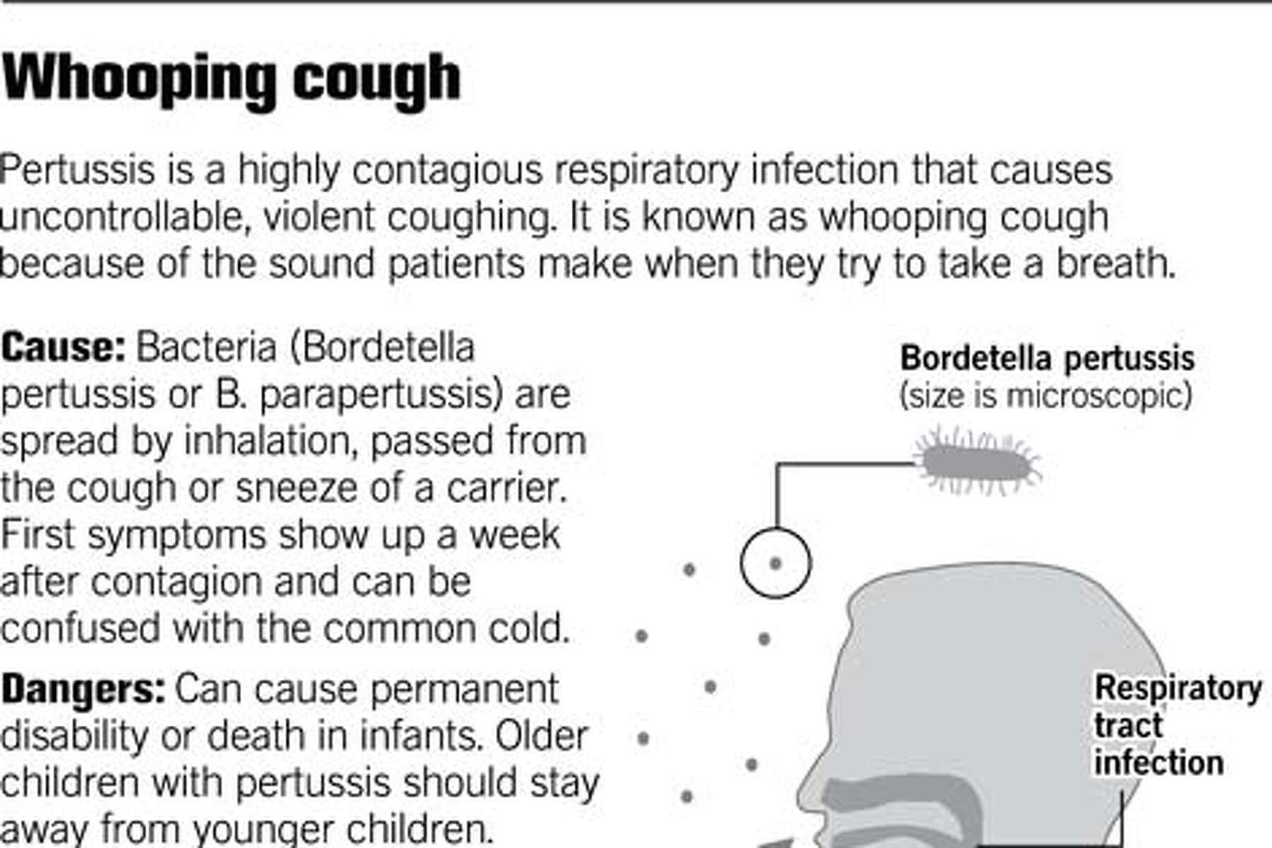 Whooping Cough Bacteria Black And White