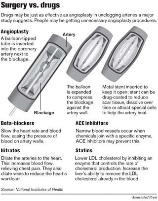 Drug therapy for heart as effective as surgery / Patients who elect ...