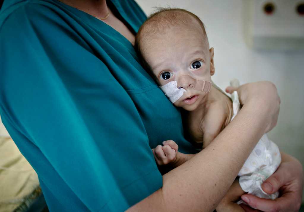 Transplant possible for Romania baby born with stunted intestines