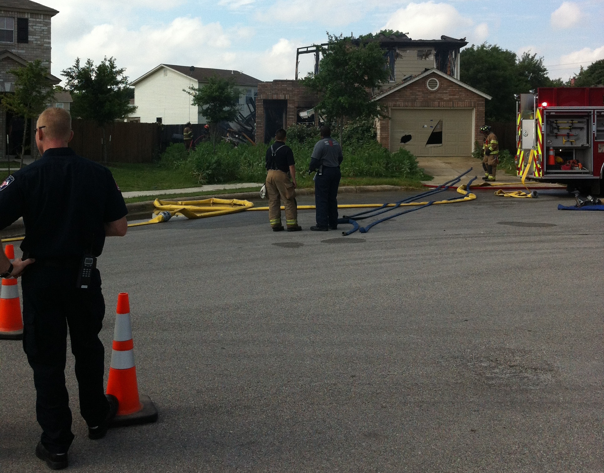 Arson suspect suffers burns on arms