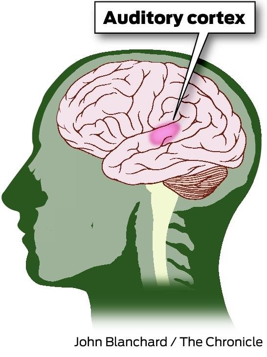 UCSF researchers decipher 'selective hearing'