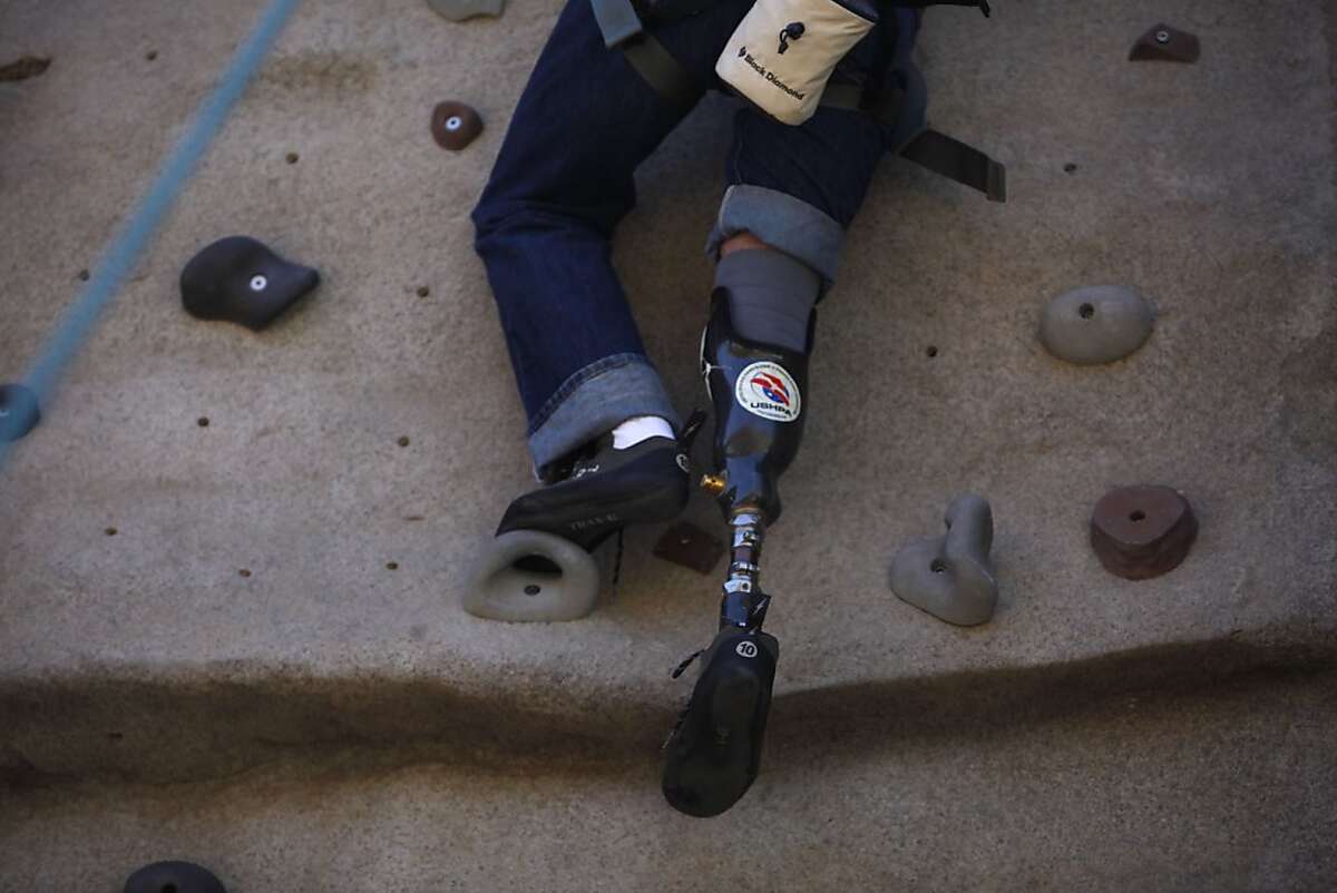 Amputees become athletes with prosthetic advances