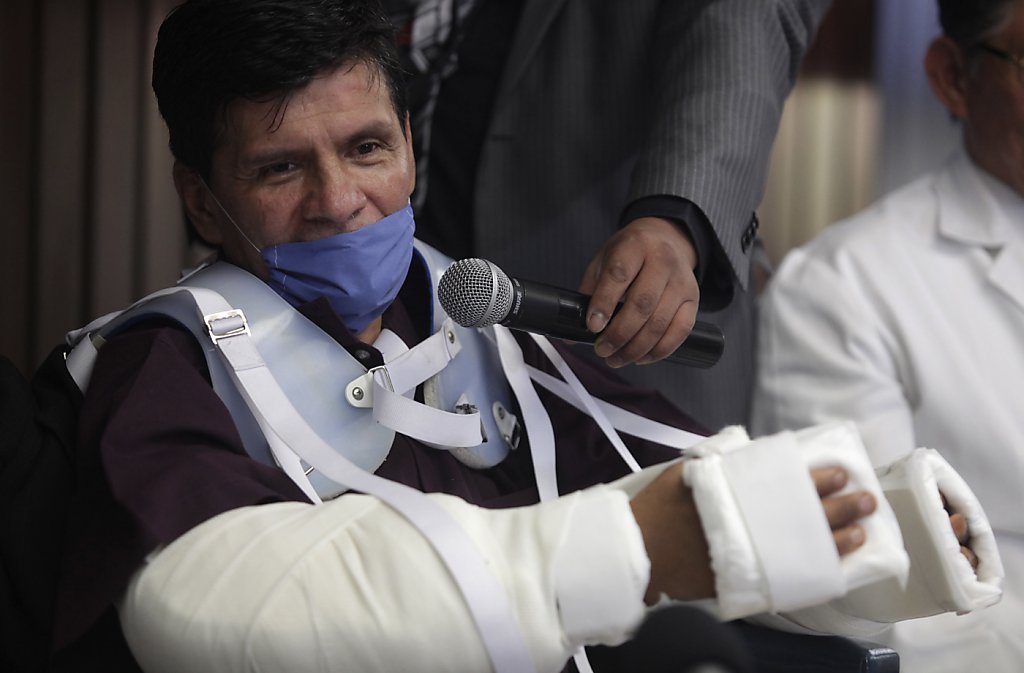 Double amputee receives two-arm transplant in Mexico