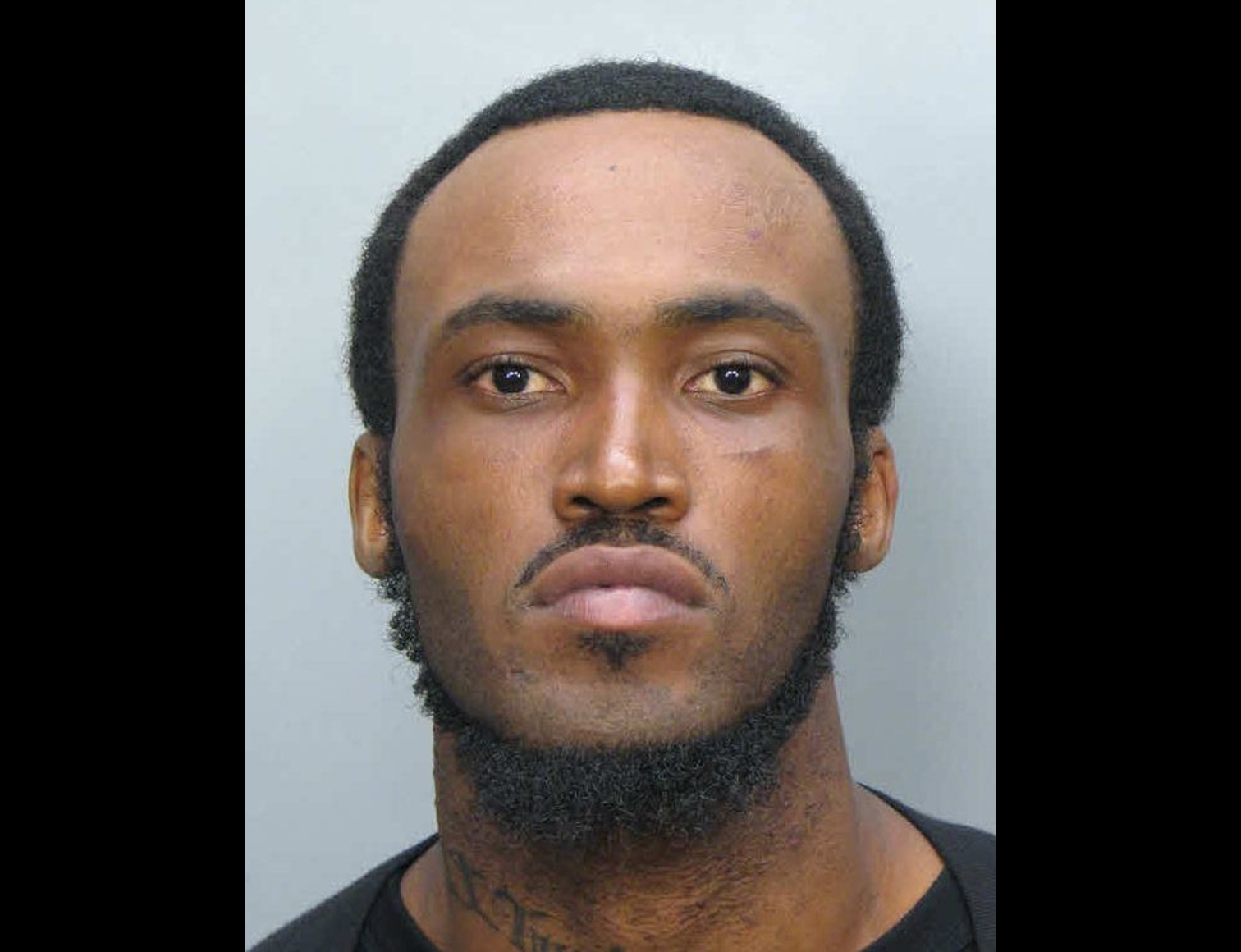 Toxicology results back on Miami face-chew attacker