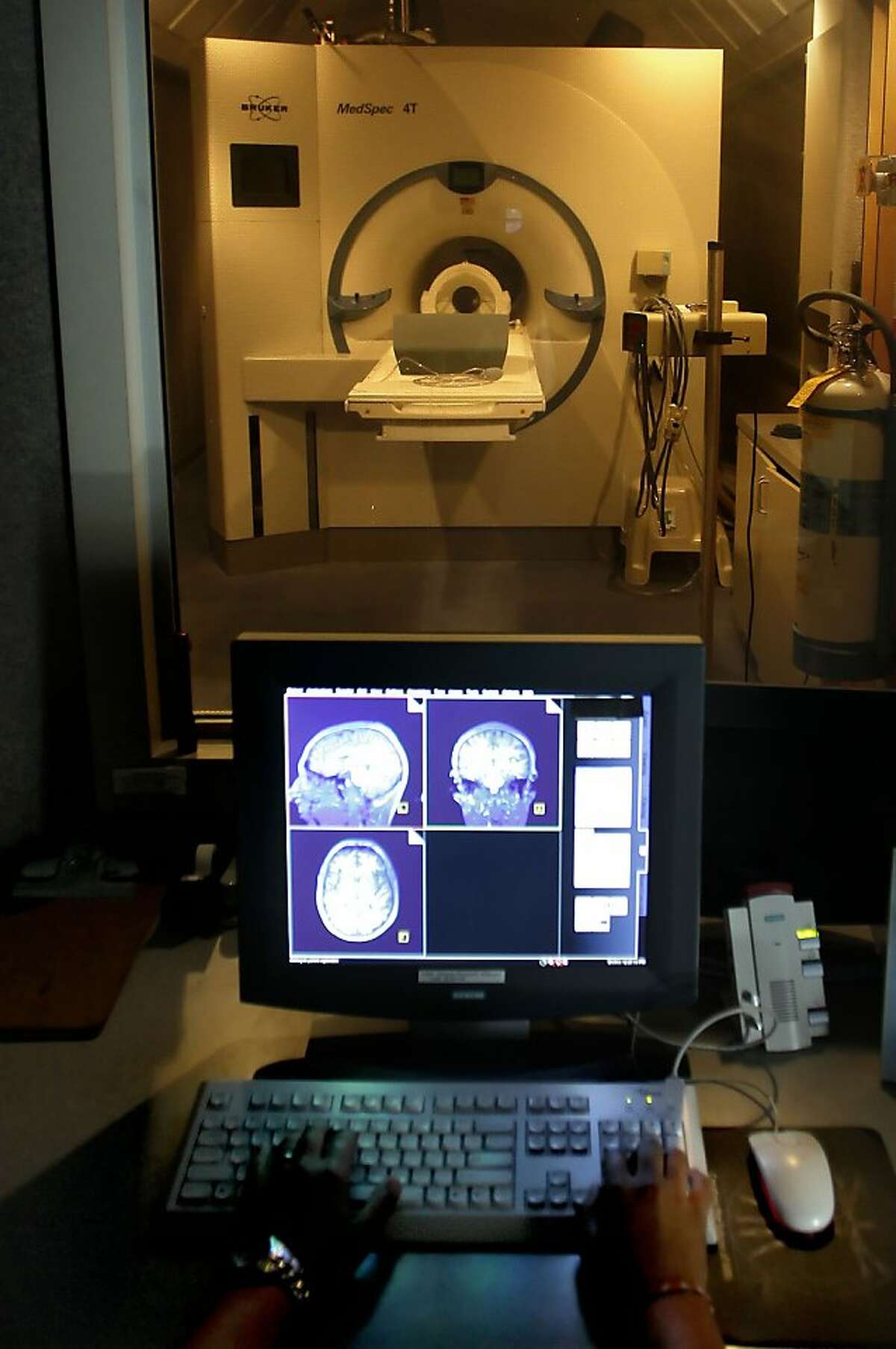 SF VA brain research technology advances